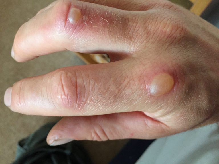 Common Hogweed – Identification, Edibility, Distribution – Galloway ...